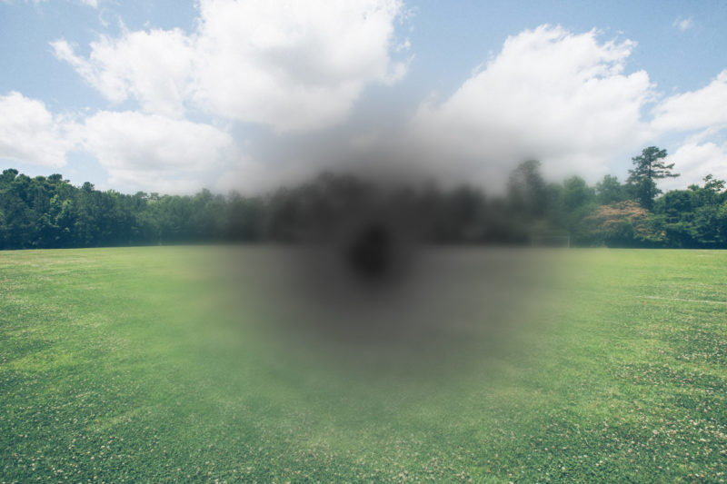 Macular Hole Surgery Hereford Eye Surgery Macular Hole Surgery Hereford Eye Surgery